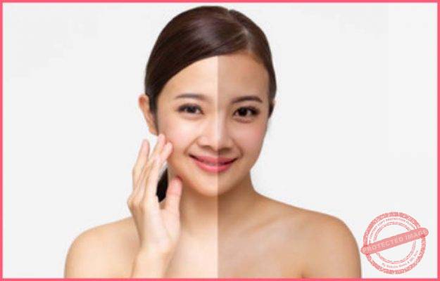 4 Dal or Pulse Face Packs For Skin Lightening and Whitening